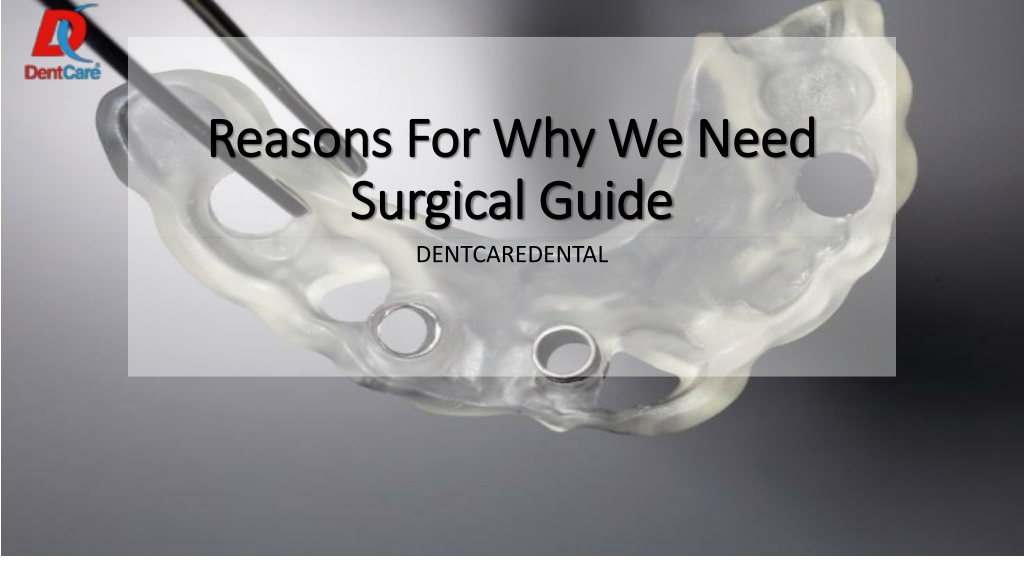 PPT - Reasons For Why We Need Surgical Guide PowerPoint Presentation ...