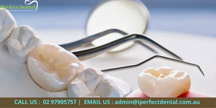 PPT - Dental Crowns and Bridges Bankstown PowerPoint Presentation, free ...