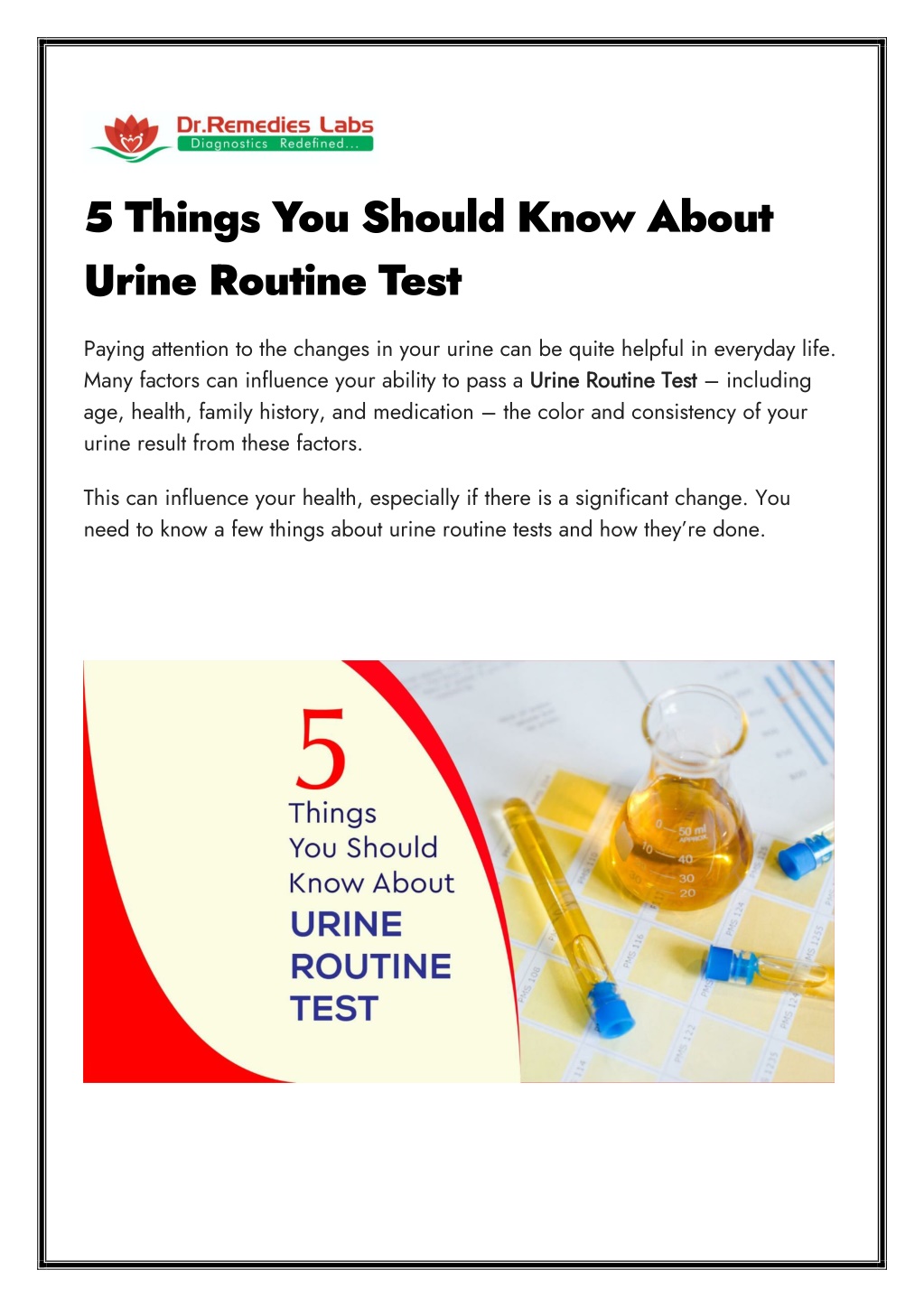 PPT - 5 Things You Should Know About Urine Routine Test PowerPoint ...