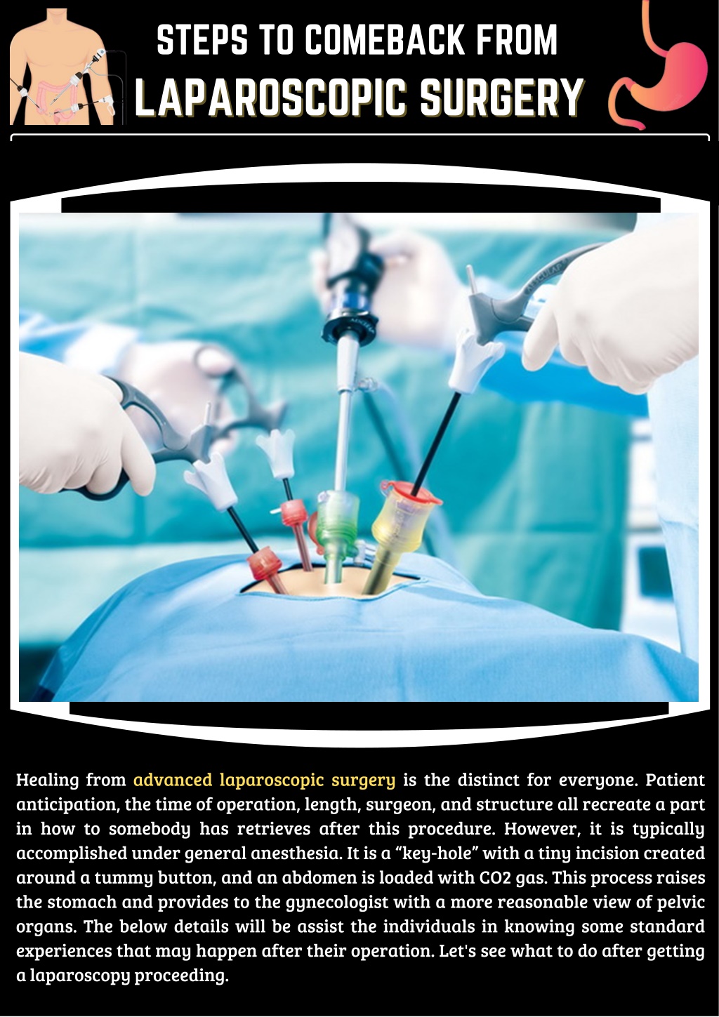 PPT - Get Recovery With Laparoscopic Surgery PowerPoint Presentation ...