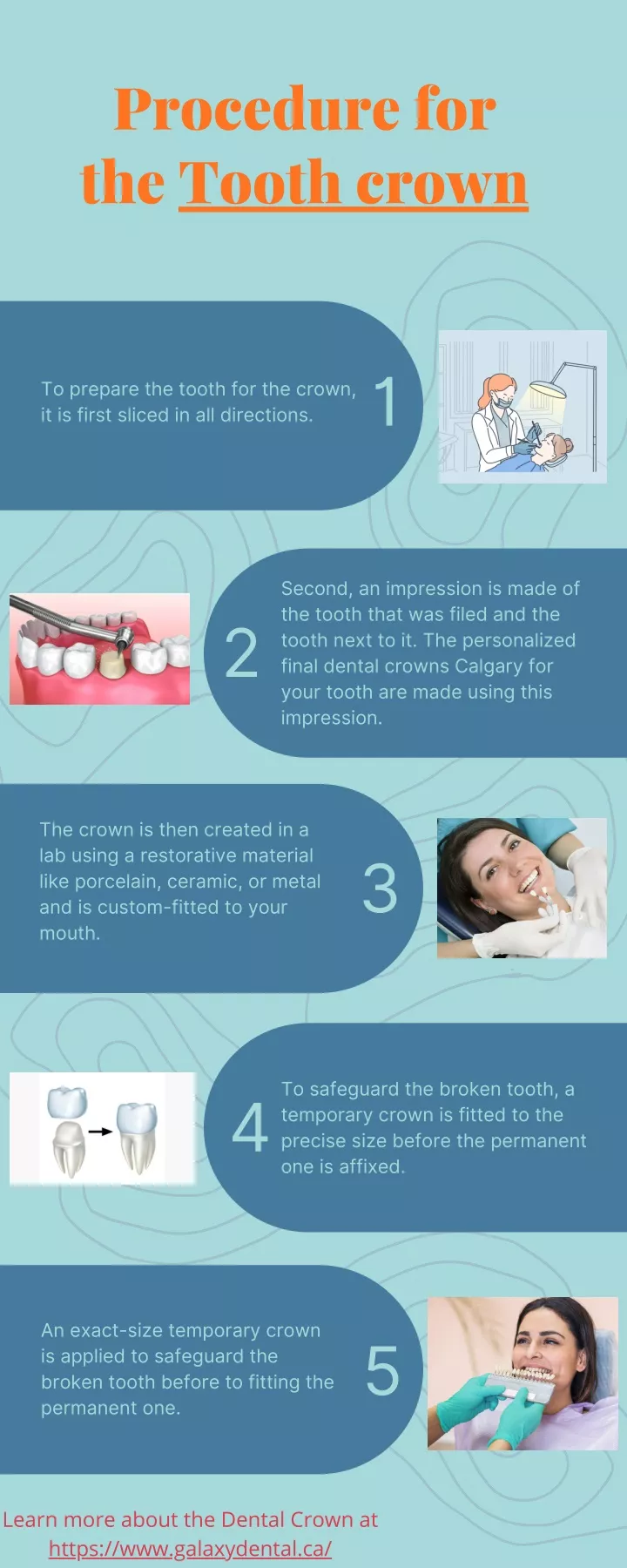 PPT - Tooth Crown Dental Calgary - Galaxy Dental PowerPoint ...