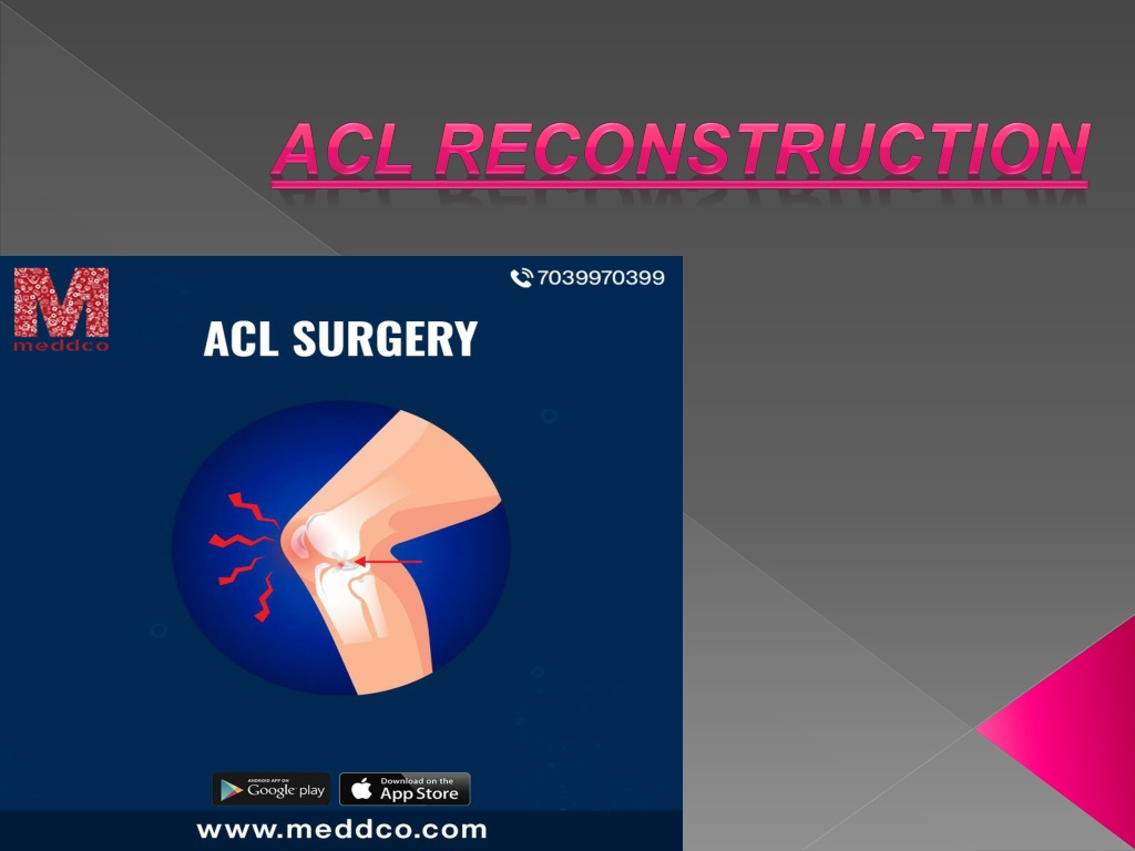 PPT - ACL reconstruction ppt PowerPoint Presentation, free download - ID:11515673