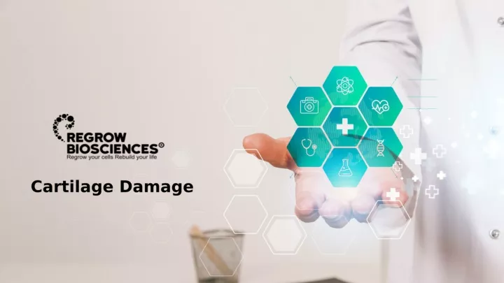 PPT - Cartilage cell therapy: A reformed way of treating knee Cartilage ...