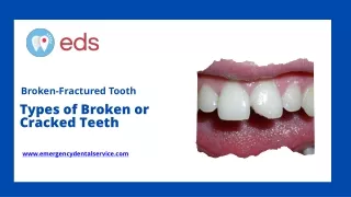 PPT - Types of Broken or Cracked Teeth | Emergency Dental Service ...
