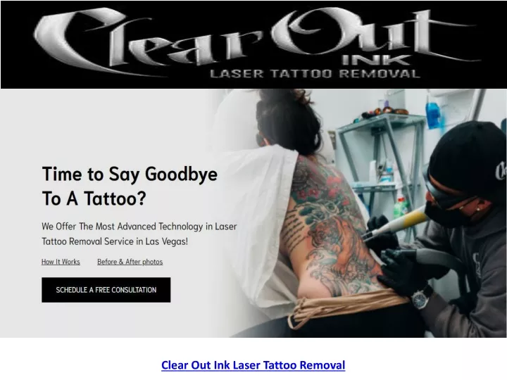 PPT - Clear Out Ink Laser Tattoo Removal PowerPoint Presentation, free ...
