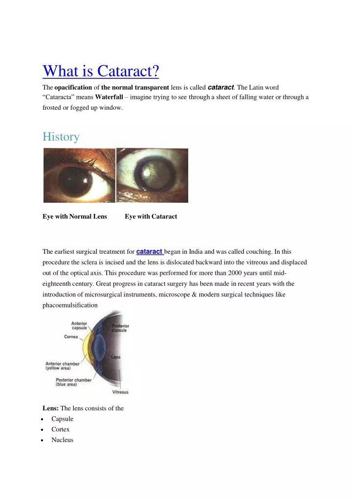 PPT - Best Hospital for Cataract Surgery in Mumbai PowerPoint ...