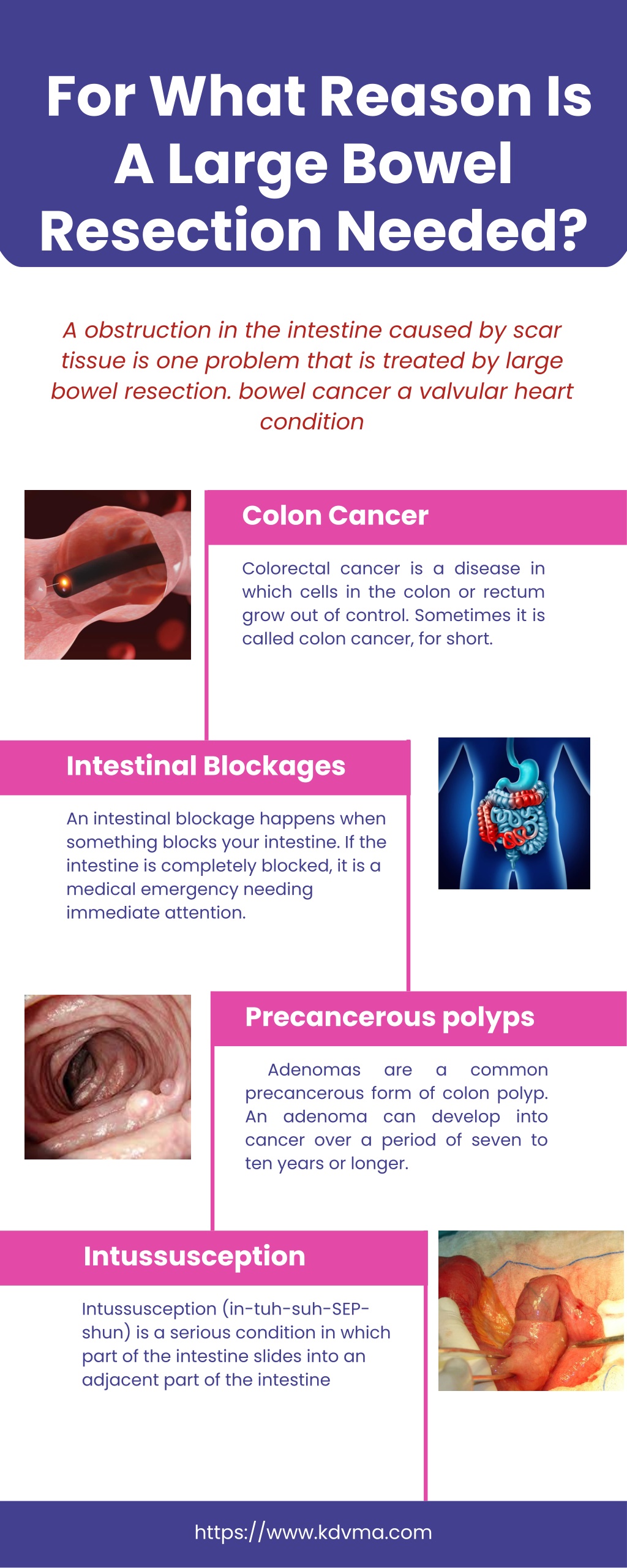 PPT - For What Reason Is A Large Bowel Resection Needed PowerPoint ...