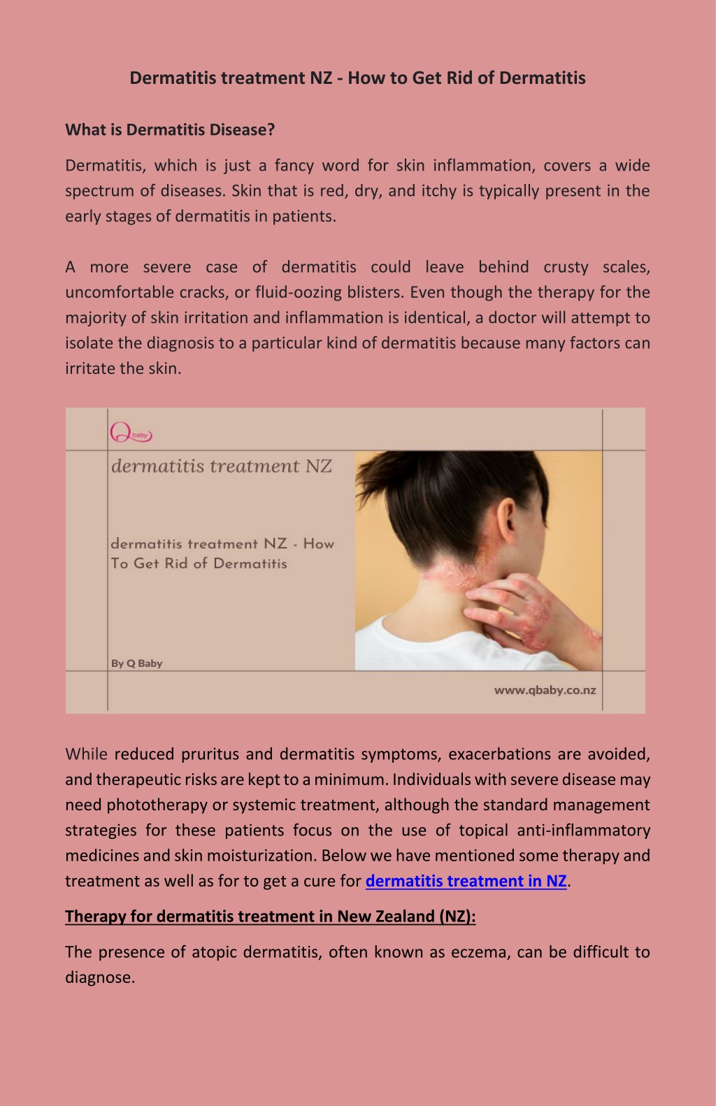 PPT - dermatitis treatment NZ - How To Get Rid of Dermatitis PowerPoint ...