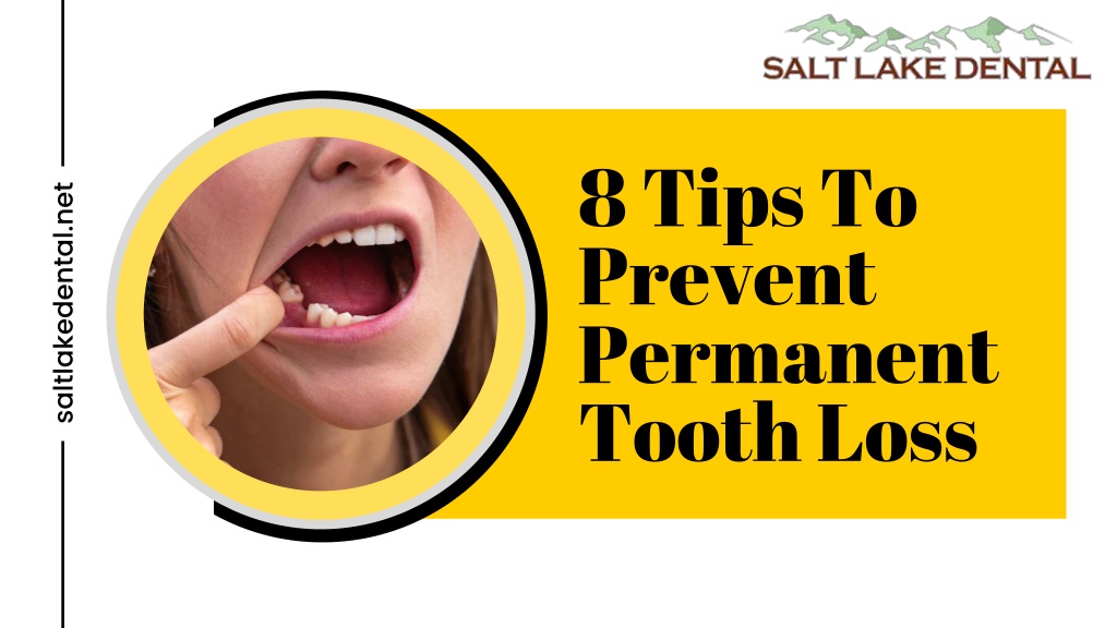 PPT - Tips To Prevent Permanent Tooth Loss PowerPoint Presentation ...