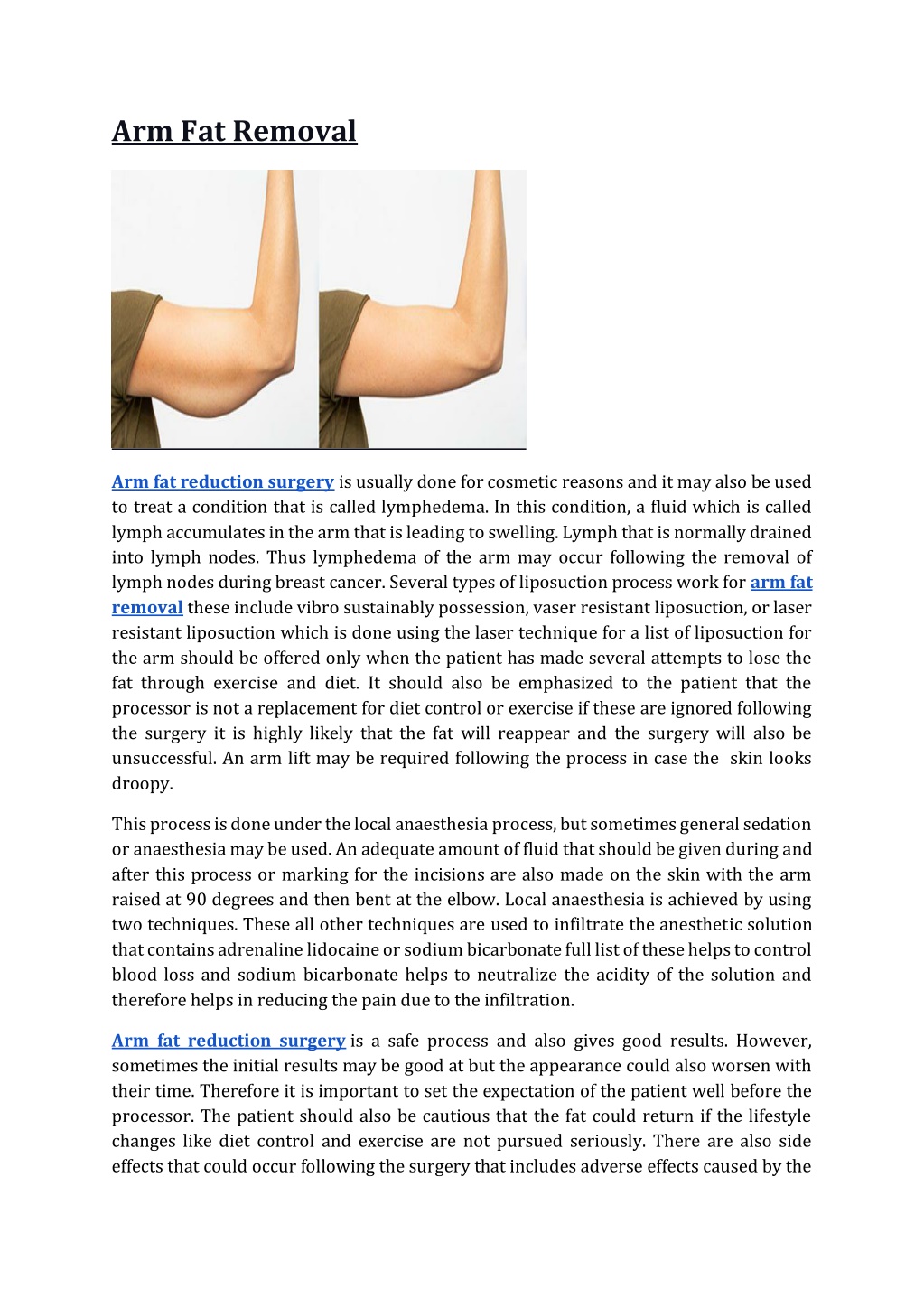 PPT - Arm Fat Removal PowerPoint Presentation, free download - ID:11861479