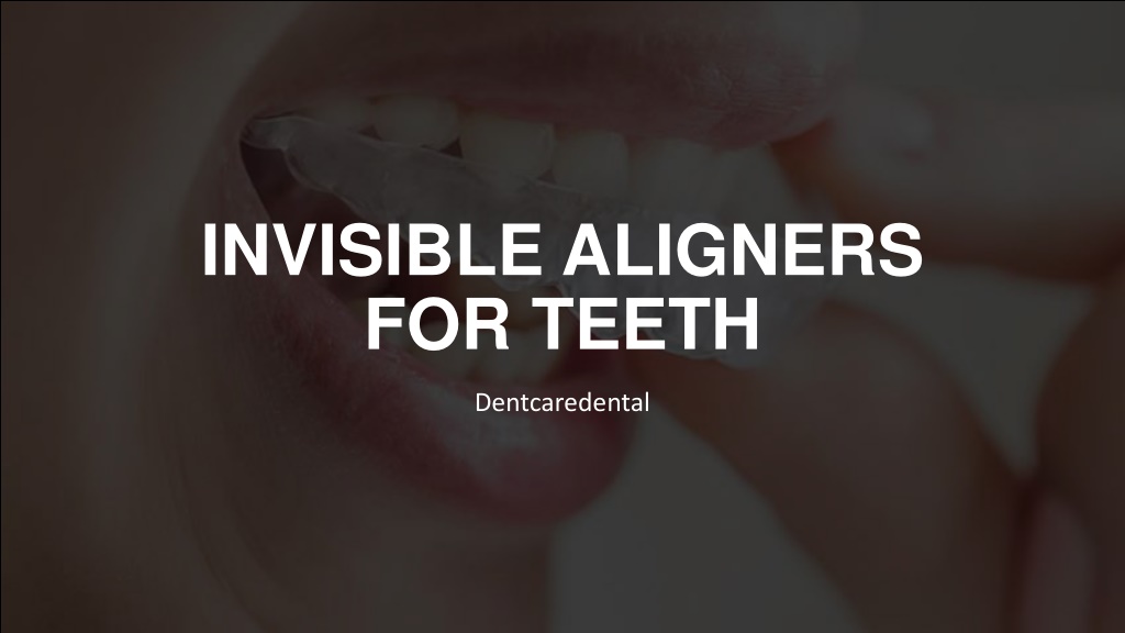 PPT - INVISIBLE ALIGNERS FOR TEETH PowerPoint Presentation, free ...