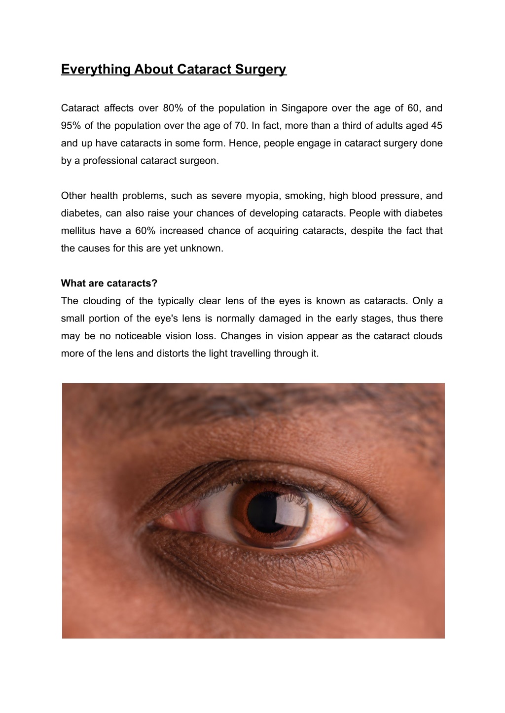 PPT - Everything about cataract surgery PowerPoint Presentation, free ...
