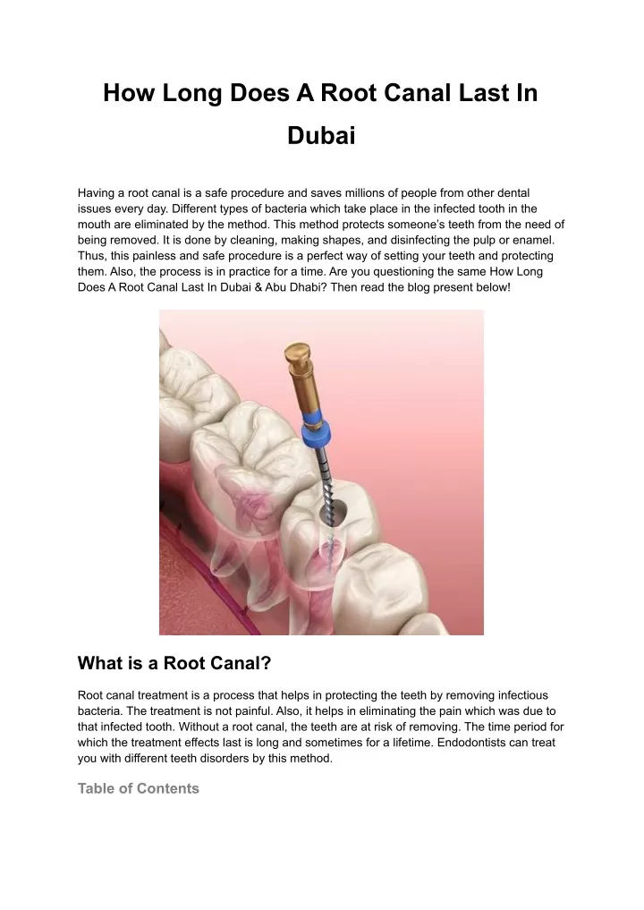 PPT - How Long Does A Root Canal Last In Dubai PowerPoint Presentation ...