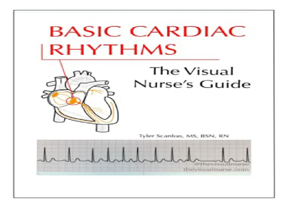 PPT - PDF Basic Cardiac Rhythms: The Visual Nurse's Guide Android PowerPoint Presentation - ID ...