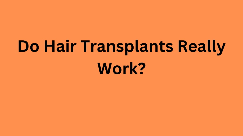 PPT - Do Hair Transplants Really Work PowerPoint Presentation, free ...